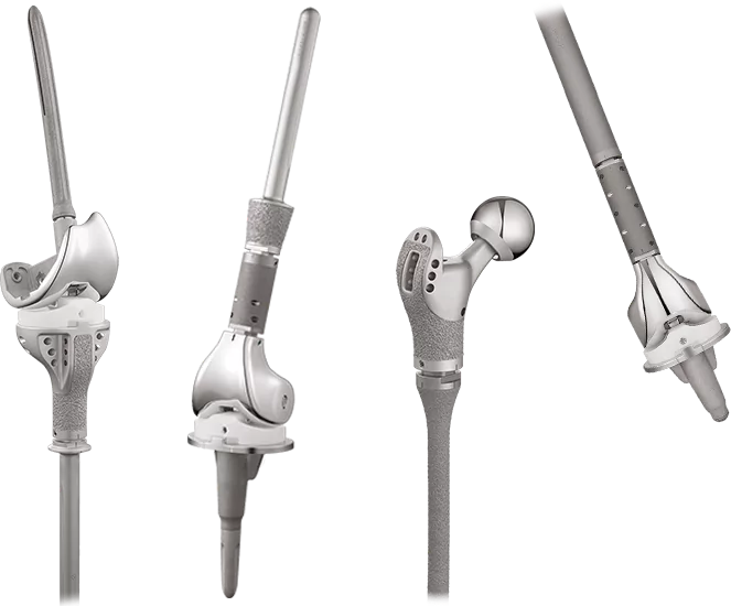 USTAR II™ | Limb Salvage | United Orthopedic Corporation